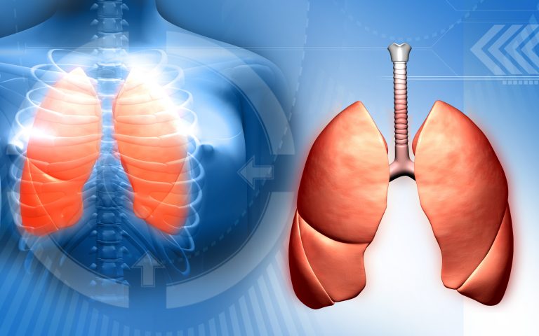 Lungenfibrose - aktuelle Forschungsergebnisse zur idiopathischen Lungenfibrose